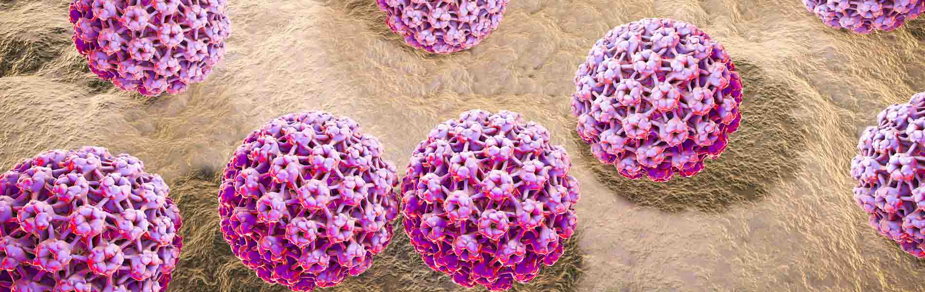 Κονδυλώματα | Συμπτώματα, διάγνωση & θεραπεία